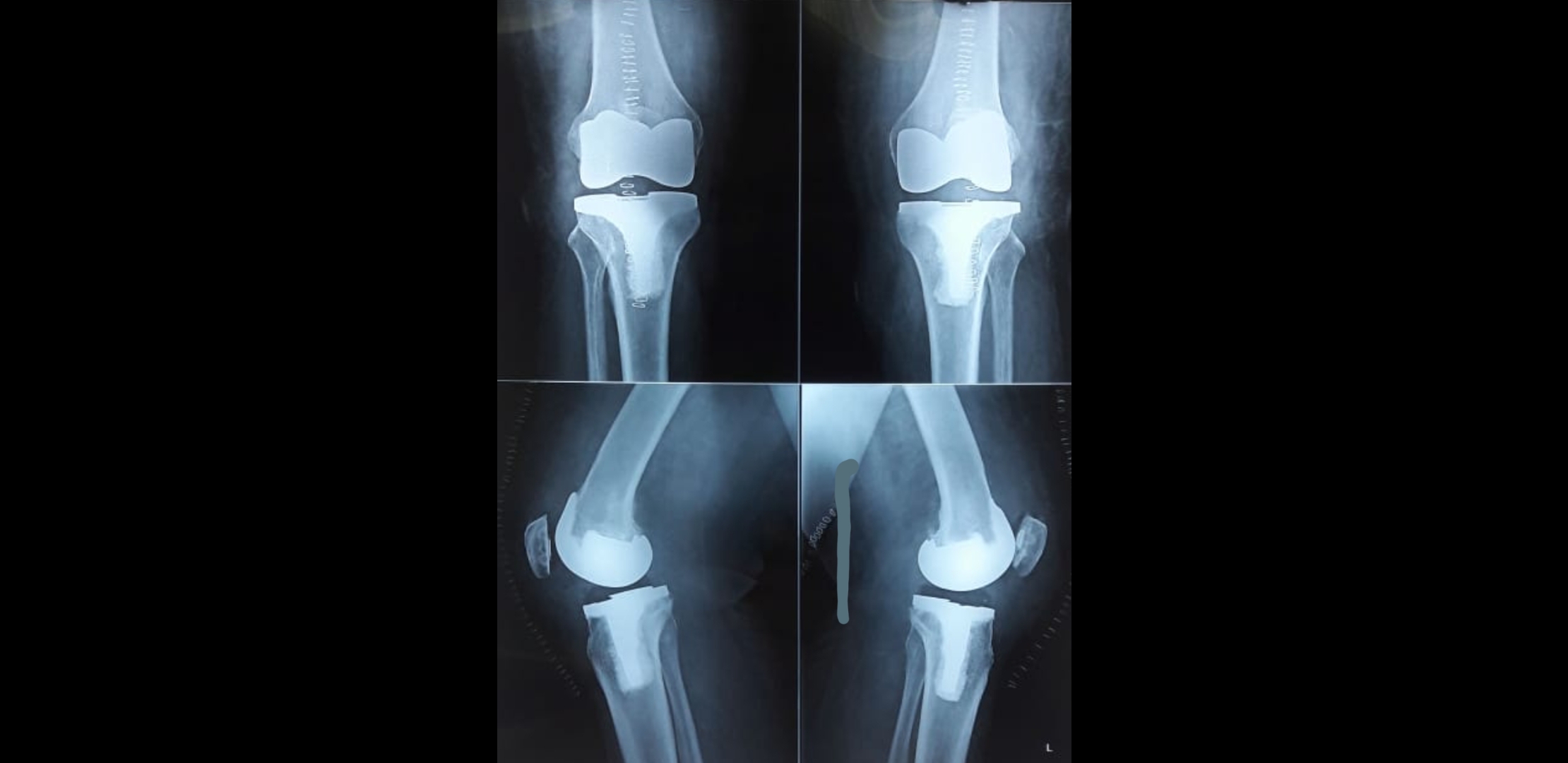 Gallery | Joint and Bone Solutions